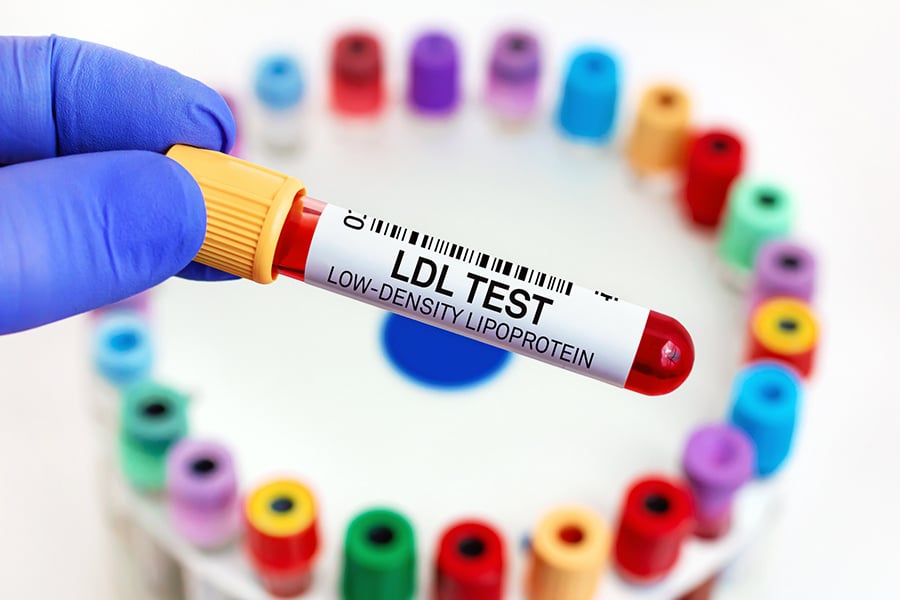 Should apoB replace cholesterol and LDL as our measure of lipid risk?