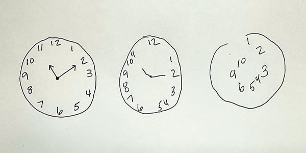 Interpretable Machine Learning and the Clock Drawing Test - CRL Corp